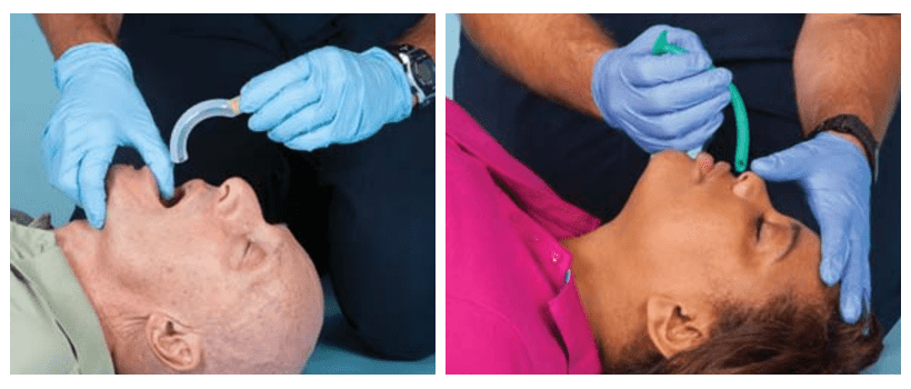 Effective Use of Oropharyngeal and Nasopharyngeal Airways | CareerCert